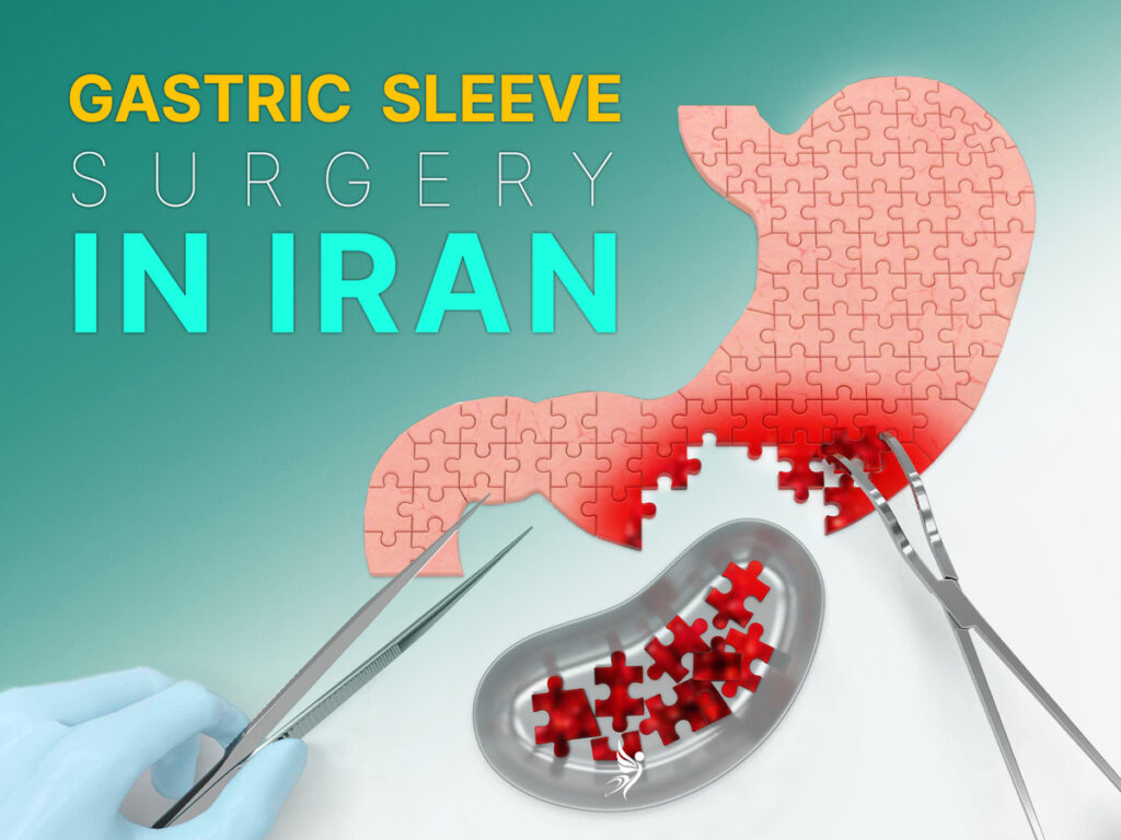 Gastric Sleeve Surgery in Iran - CarefulTrip