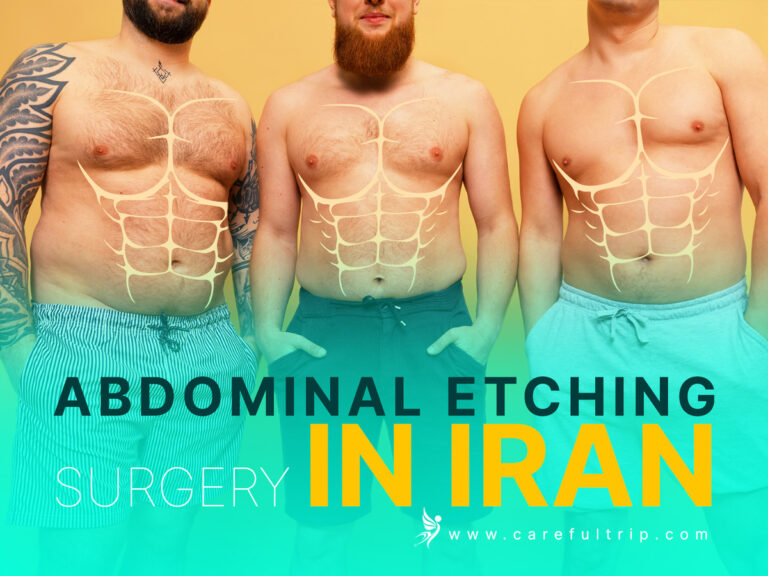 Abdominal Etching Surgery in Iran - CarefulTrip